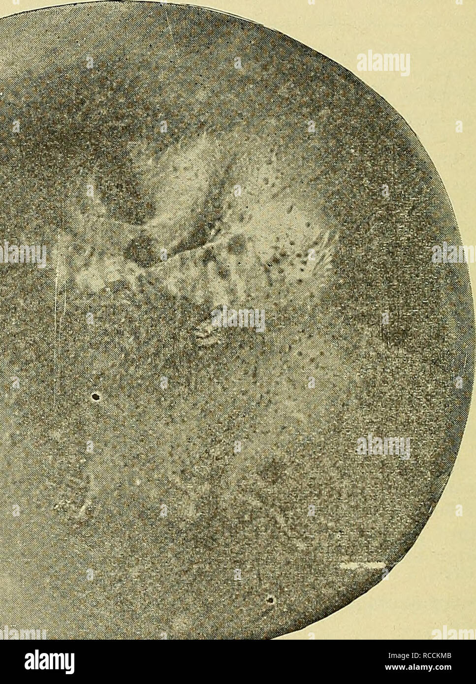 Glomerella hi-res stock photography and images - Alamy