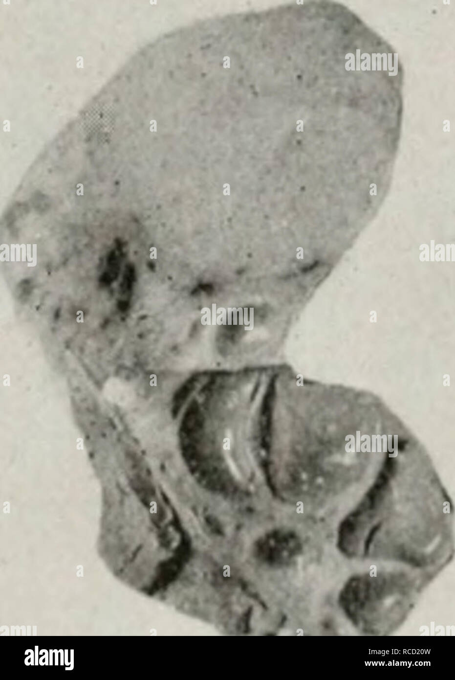 Ovarian cyst cow hi-res stock photography and images - Alamy