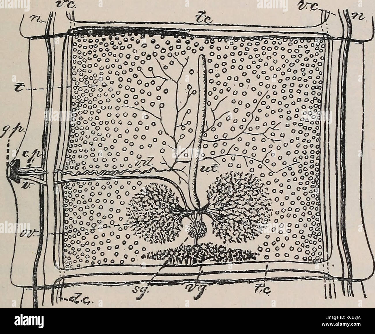 Disseminated tuberculosis hi-res stock photography and images - Alamy