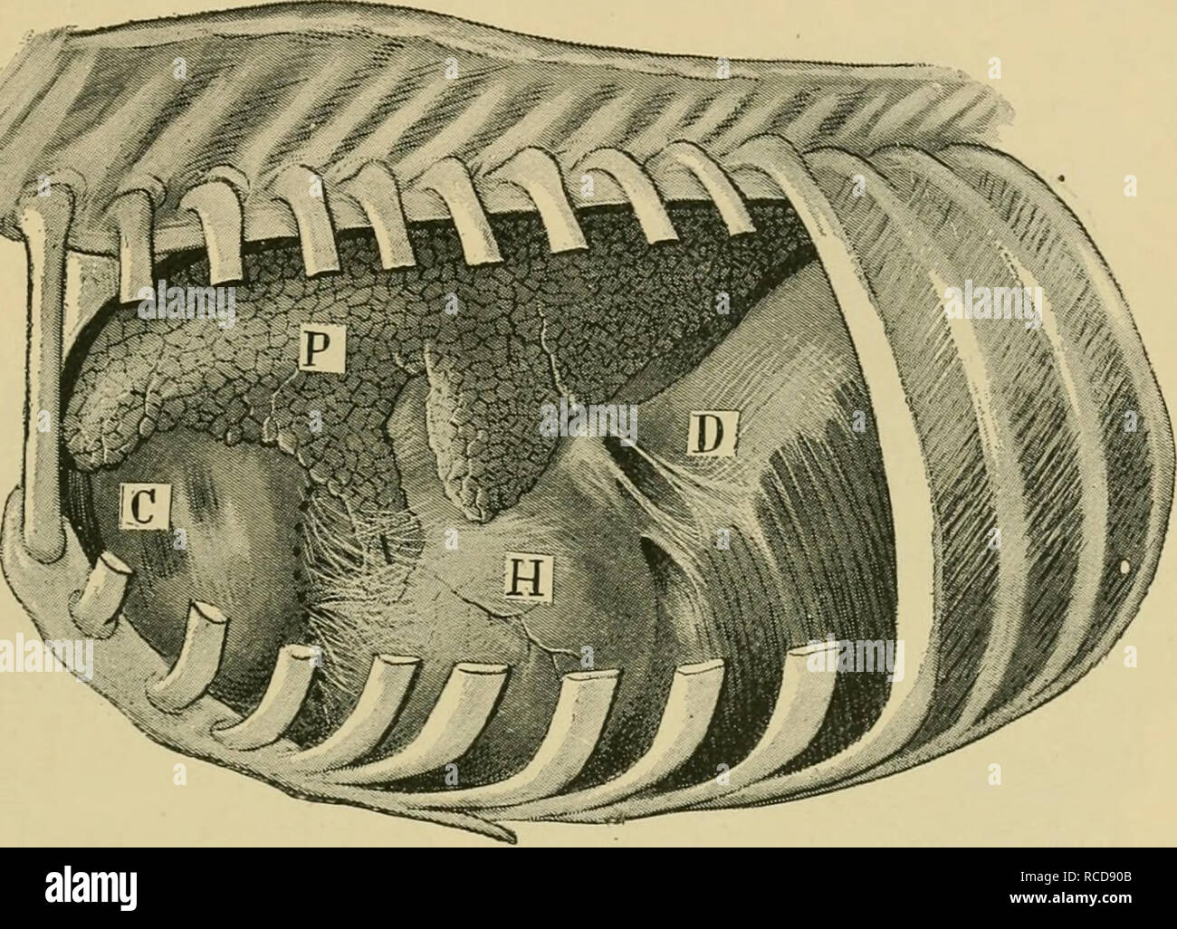 Diaphragmatic hernia hi-res stock photography and images - Alamy