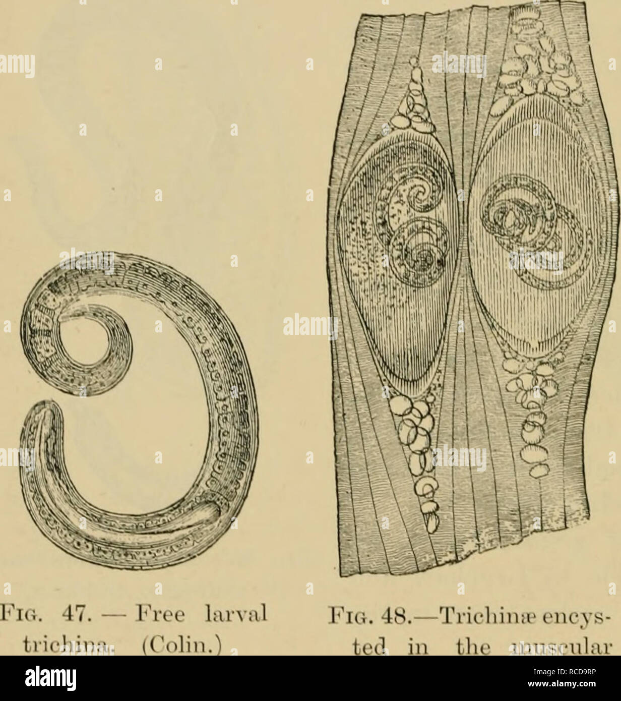 Causing colic hi-res stock photography and images - Alamy