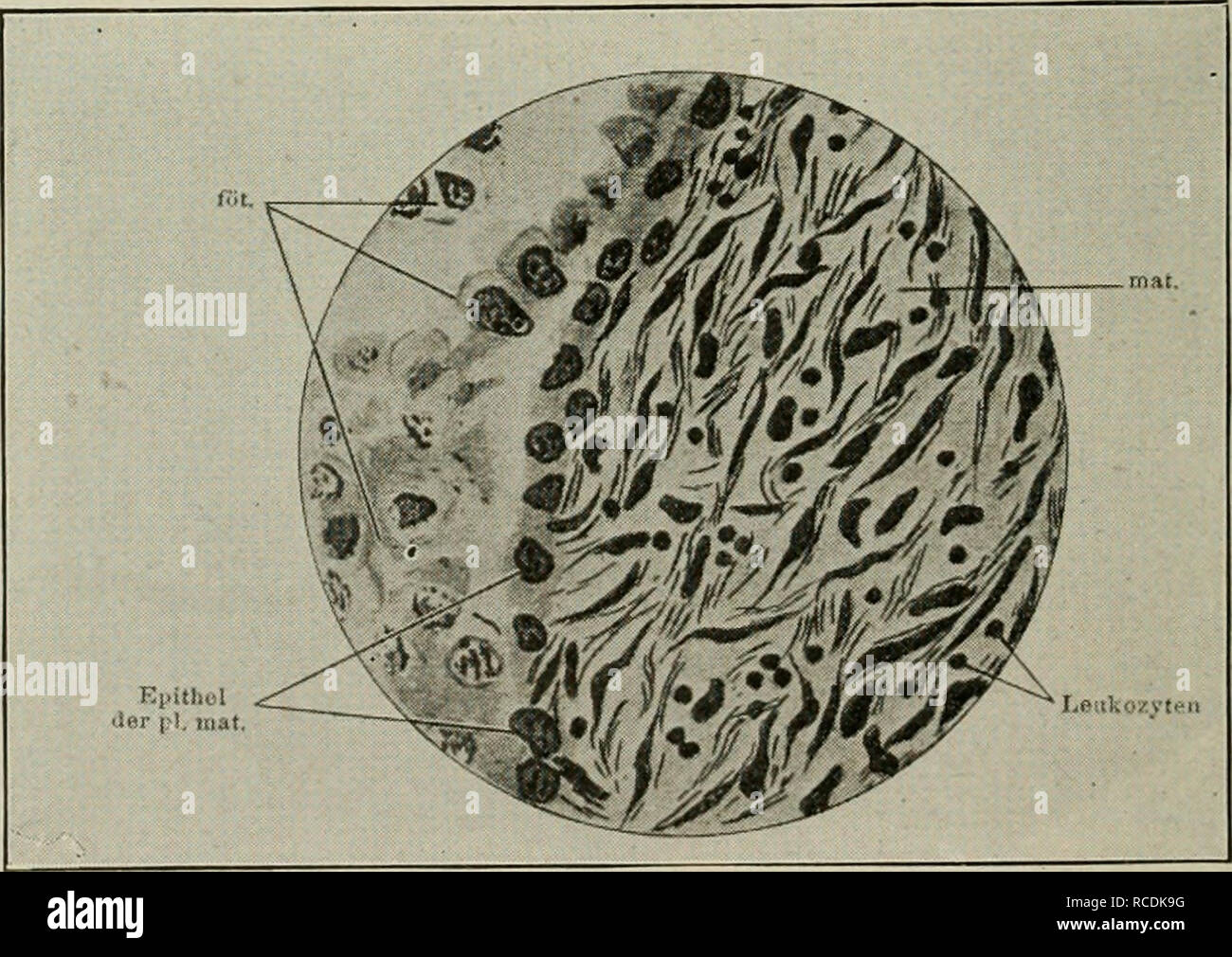 Placenta Chorionic Plate Of