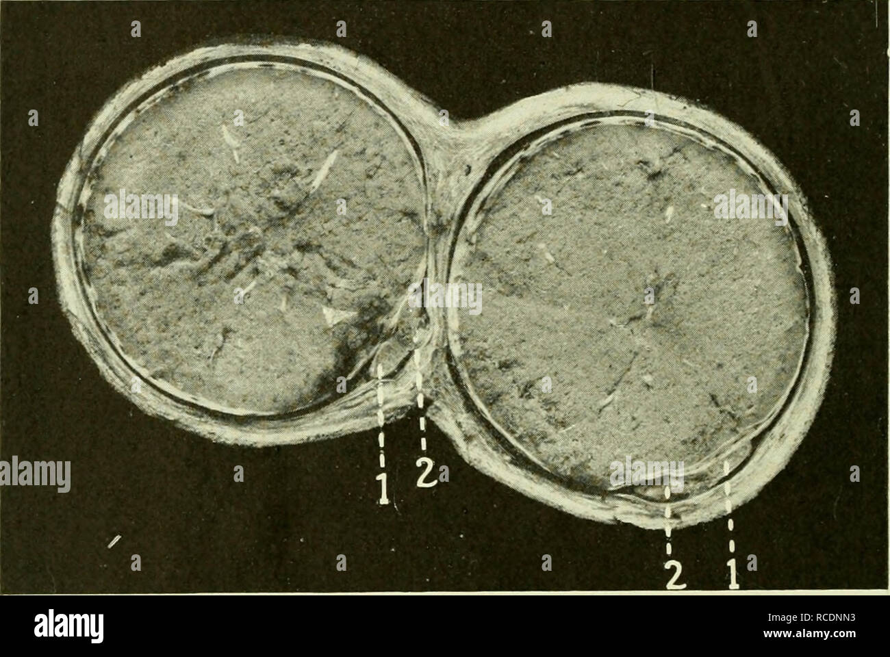 1 Testicle High Resolution Stock Photography and Images - Alamy