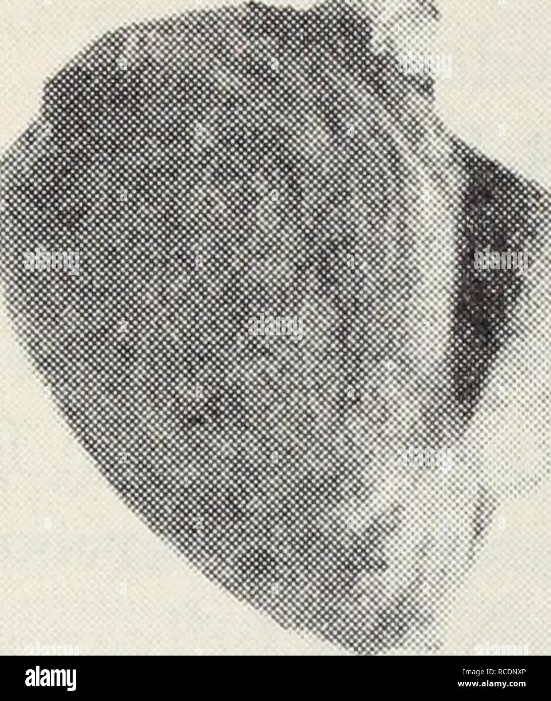 Sickly appearance hi-res stock photography and images - Alamy