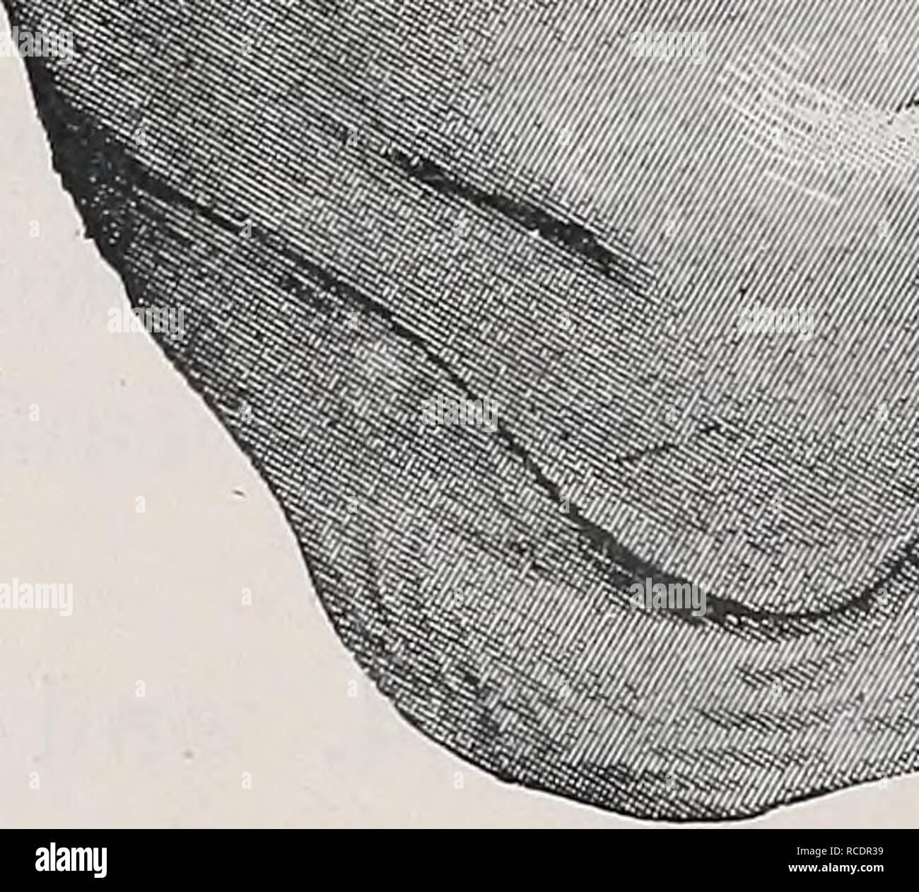 Periarticular tissues hi-res stock photography and images - Alamy