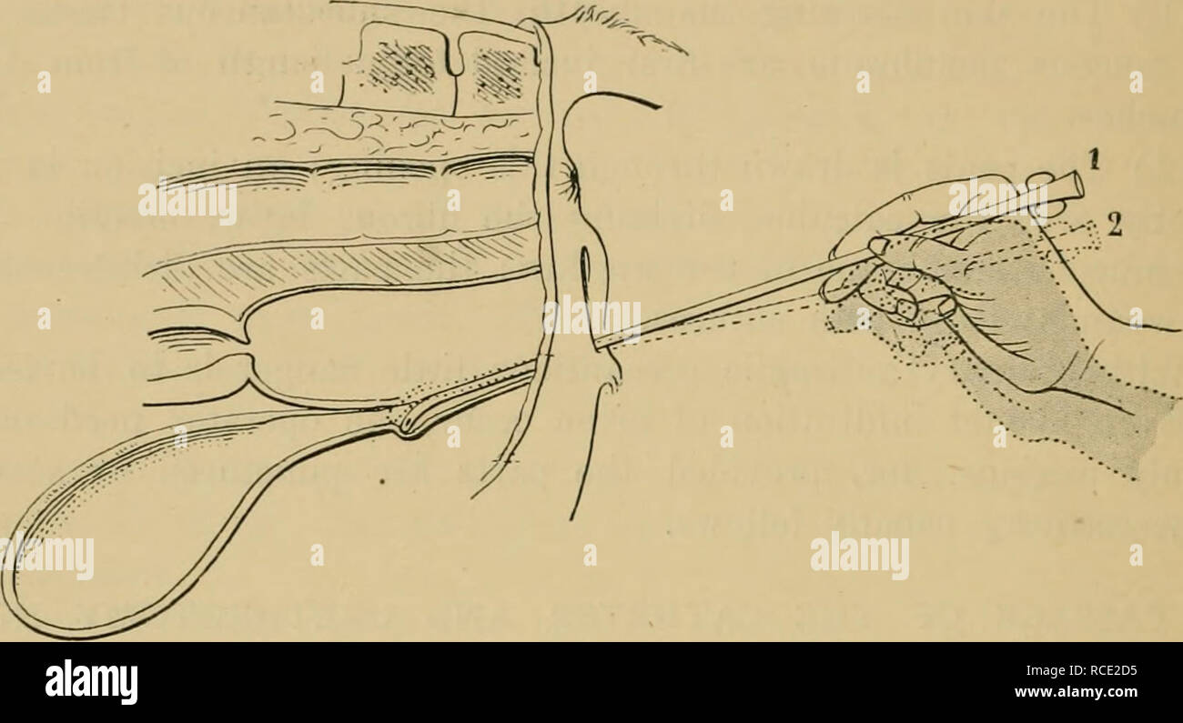 Ox Bladder High Resolution Stock Photography and Images - Alamy