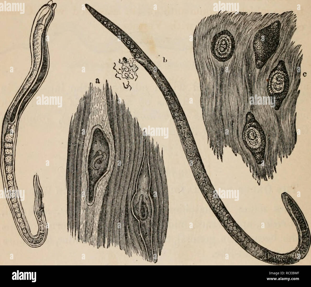 Trichina Spiralis High Resolution Stock Photography and Images - Alamy
