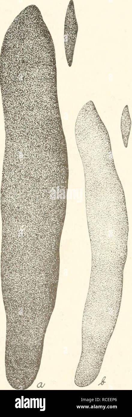 Petechiae hi-res stock photography and images - Alamy