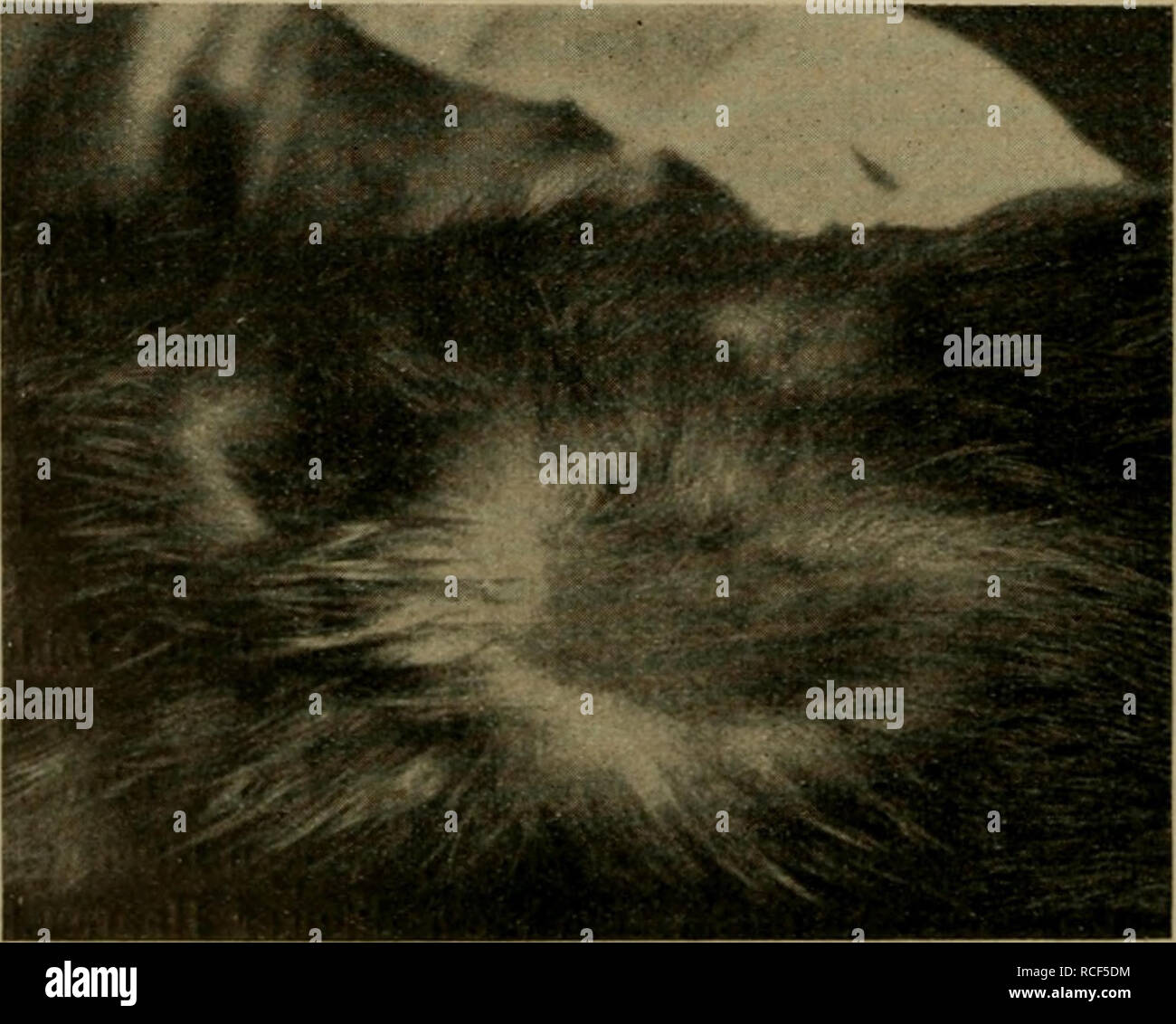 Alopecia areata images hi-res stock photography and images - Alamy