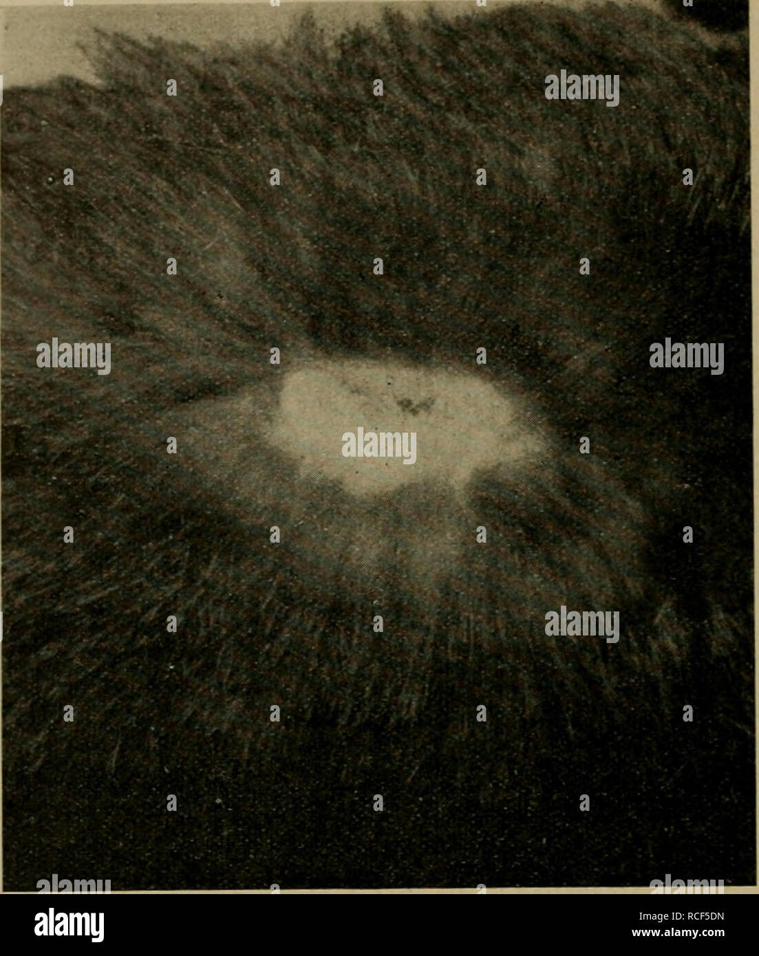 Alopecia areata images hi-res stock photography and images - Alamy