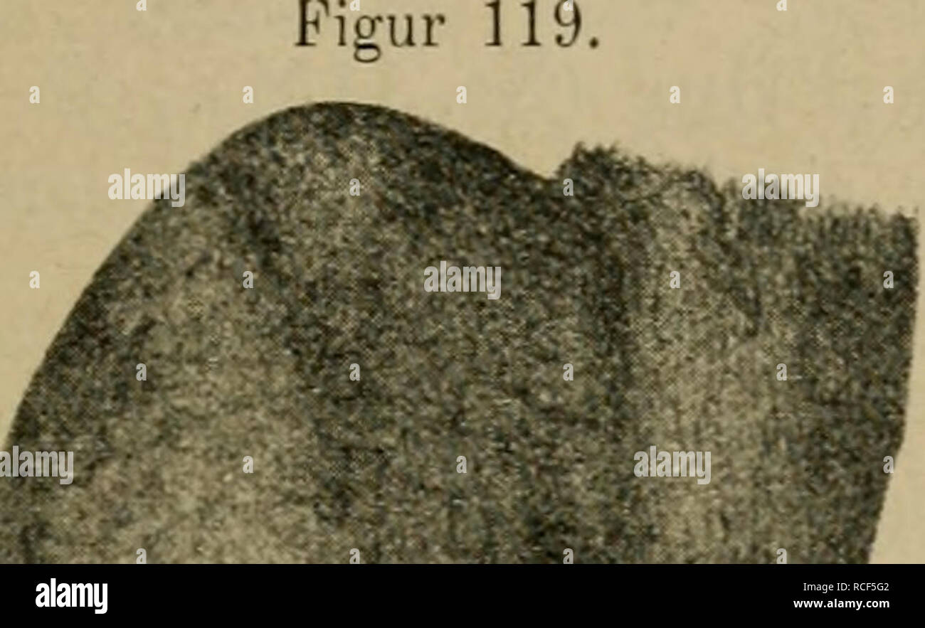 Narben haut hi-res stock photography and images - Alamy