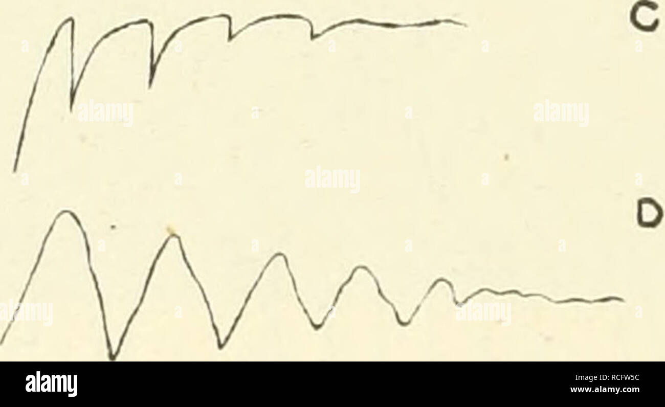 Tonic spasms hi-res stock photography and images - Alamy