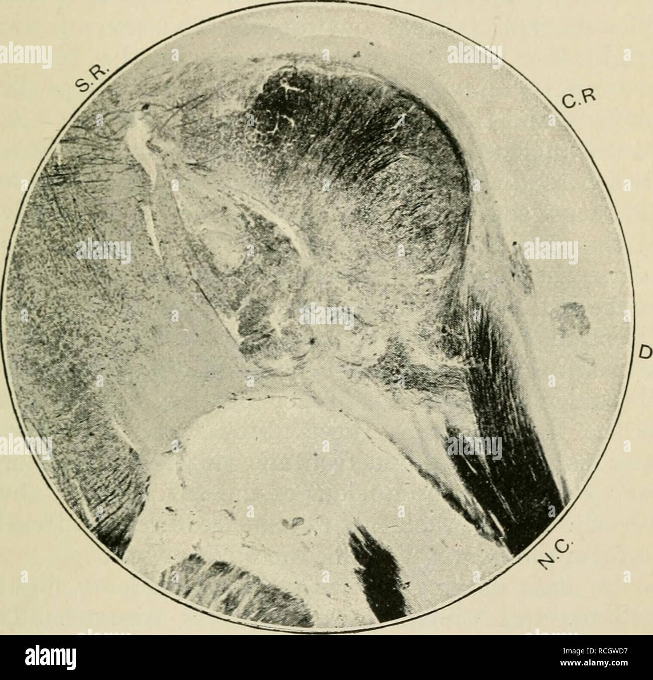 Cochlear Nerve Histology