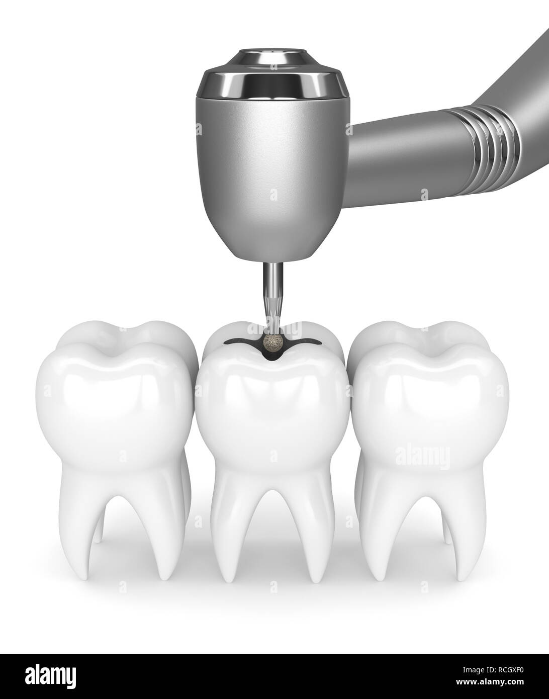 3d render of teeth with dental handpiece and drillisolated over white ...