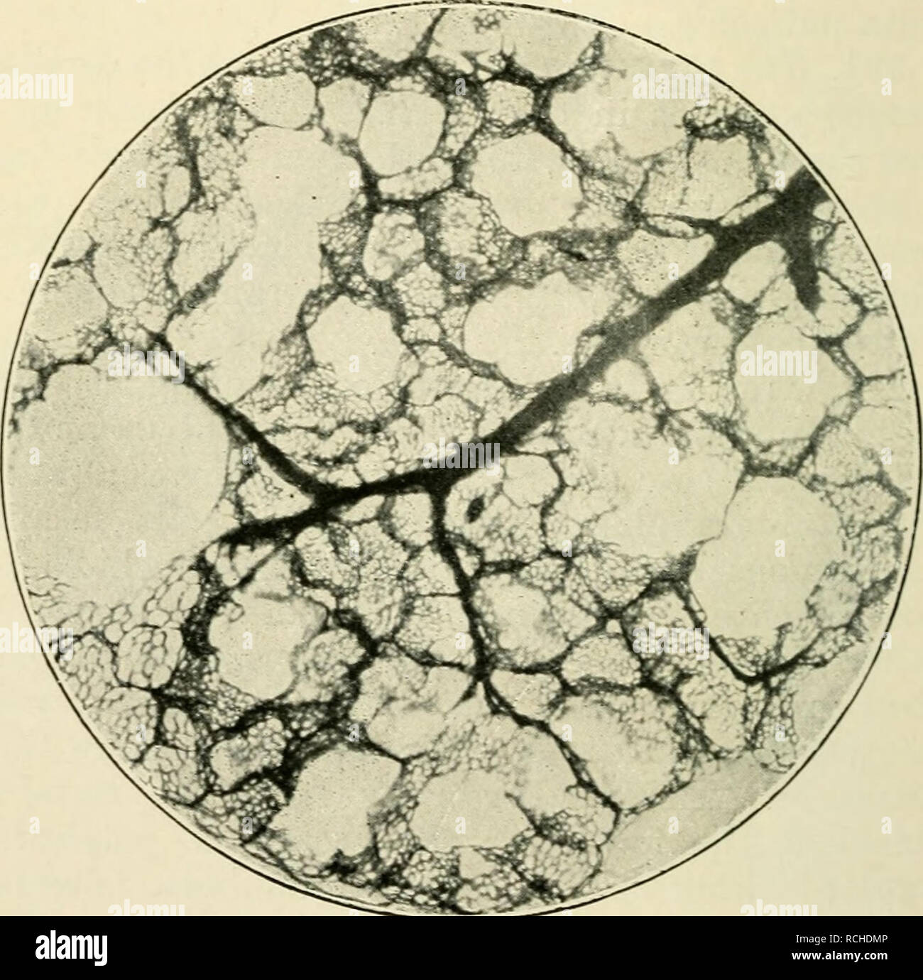 Terminal Bronchiole Histology