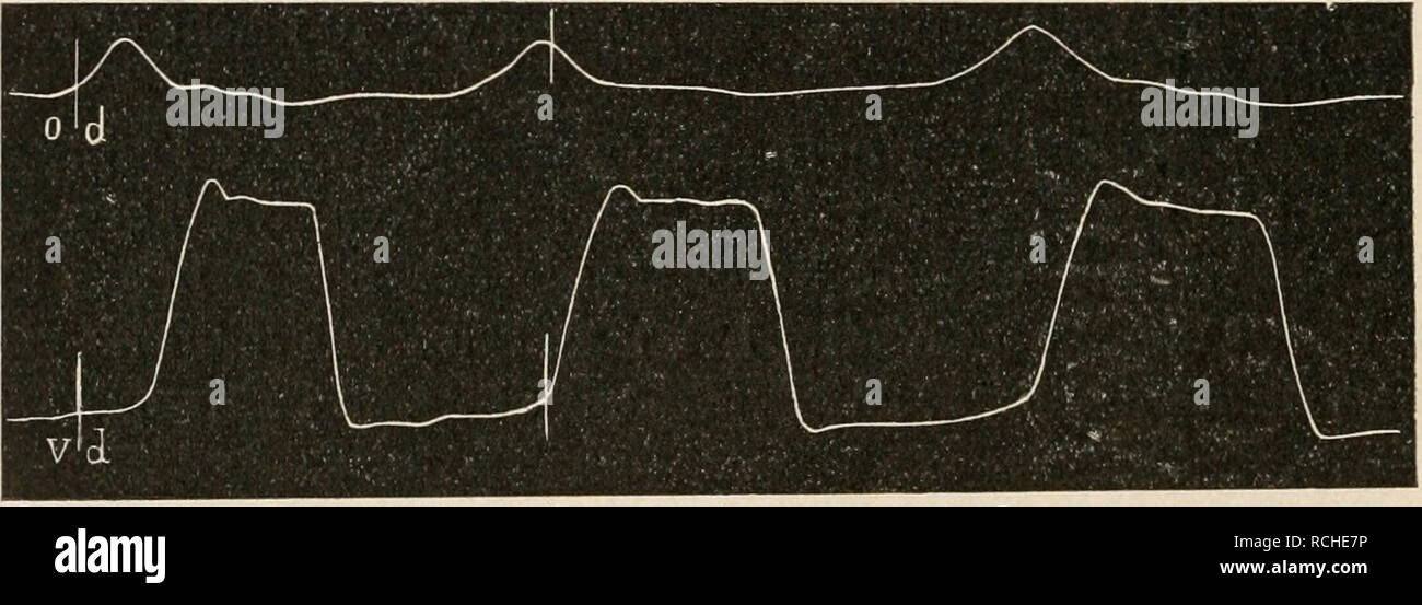 Pulsfrequenz hi-res stock photography and images - Alamy