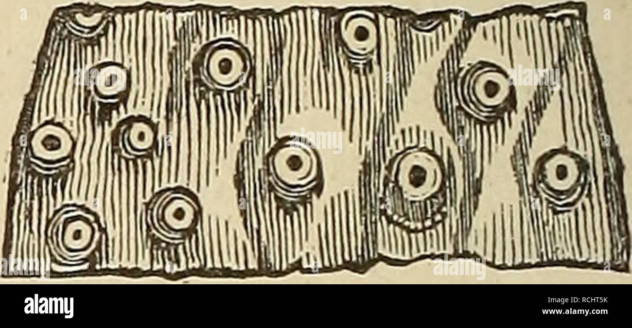 Fibrocartilage Drawing