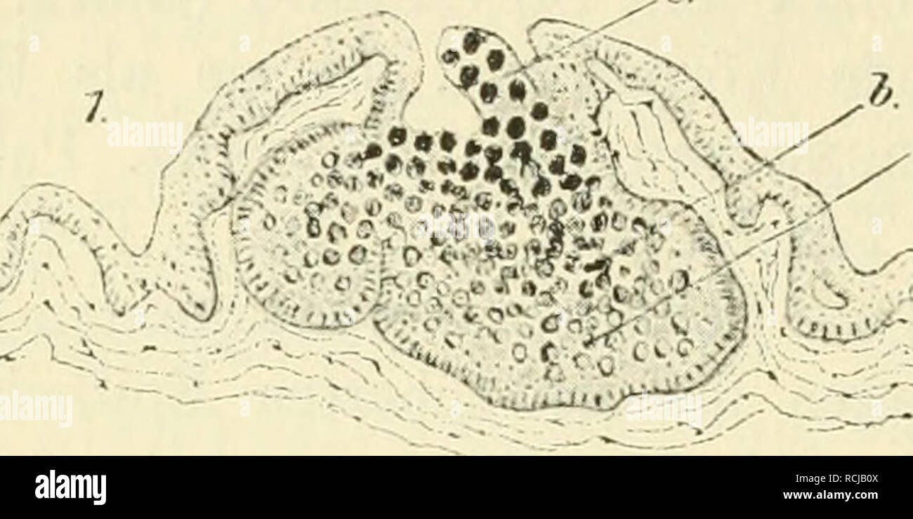 Epitheliom hi-res stock photography and images - Alamy