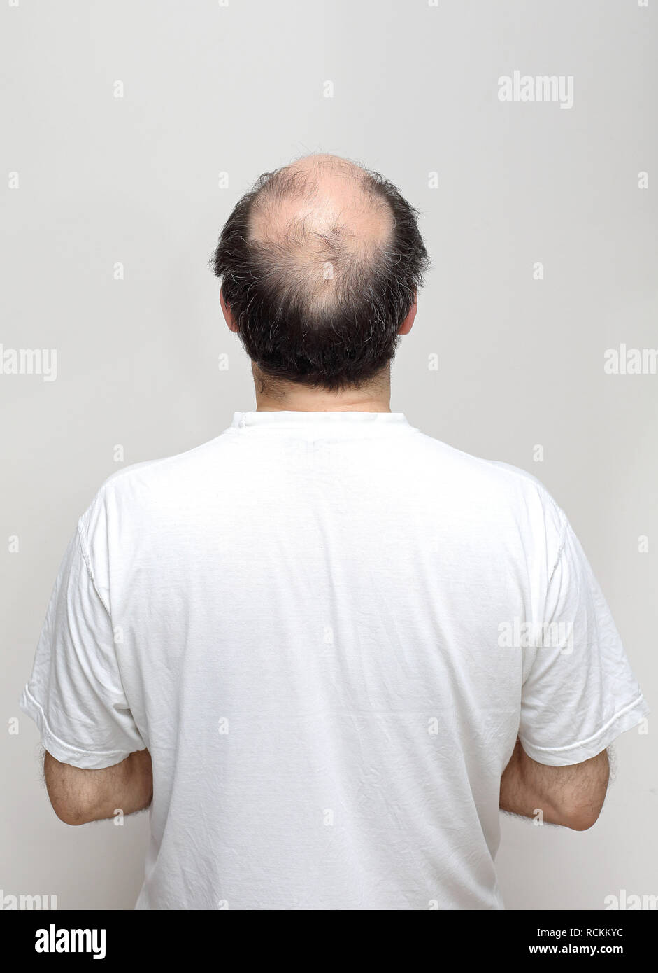 Balding head back view hi-res stock photography and images - Alamy