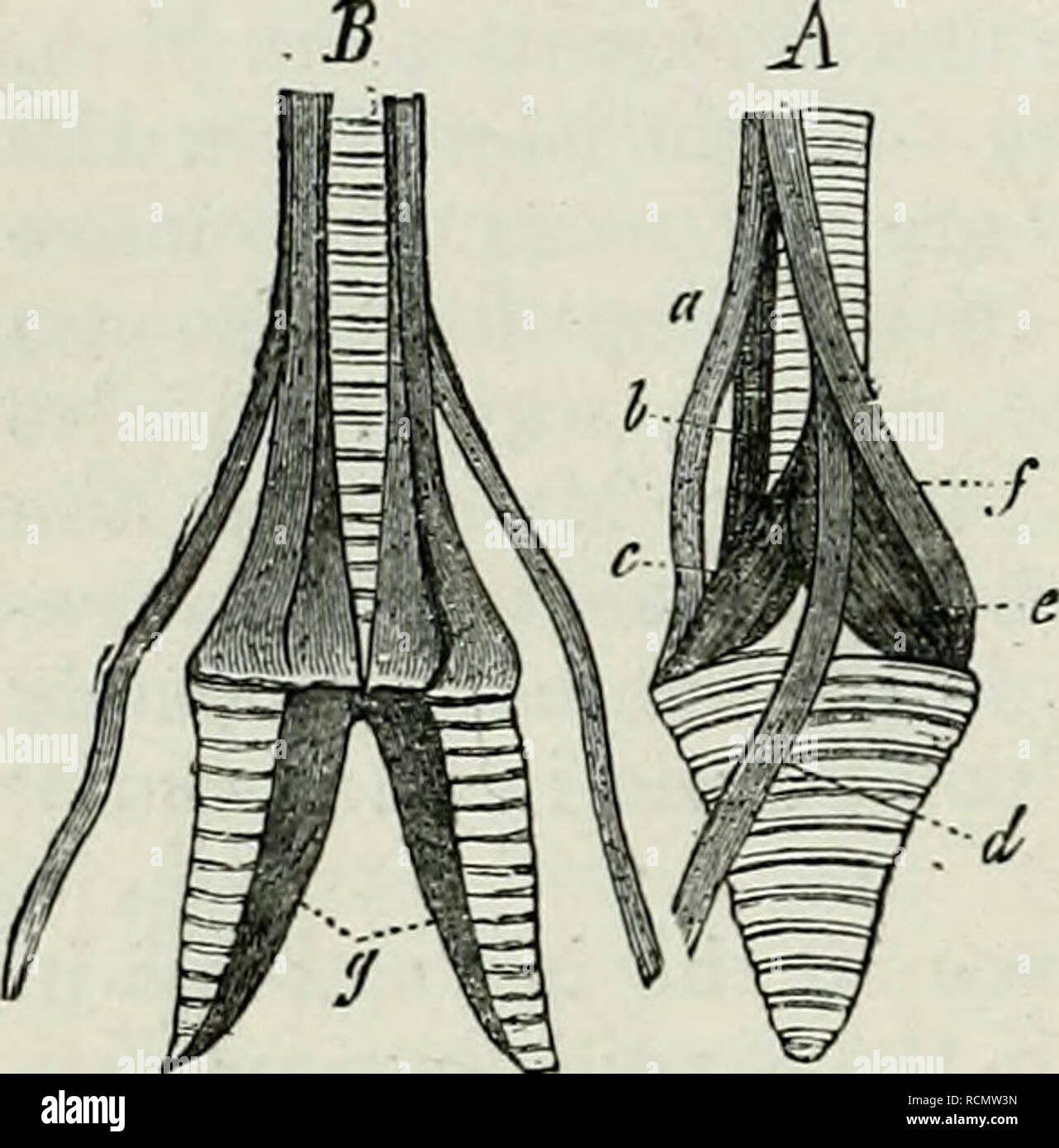 Carina Larynx TSG Trachea