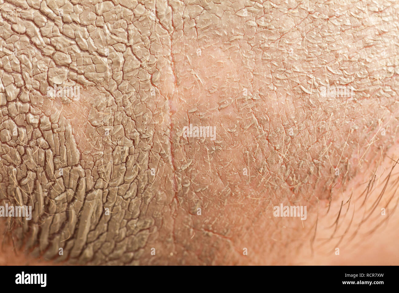 Spa beauty treatment and skin care. Closeup female face with clay mud ...