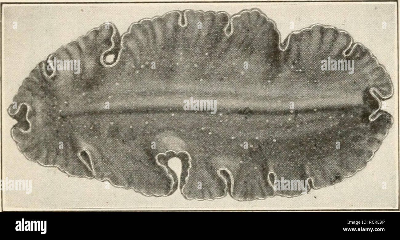 Leech mouth hi-res stock photography and images - Alamy