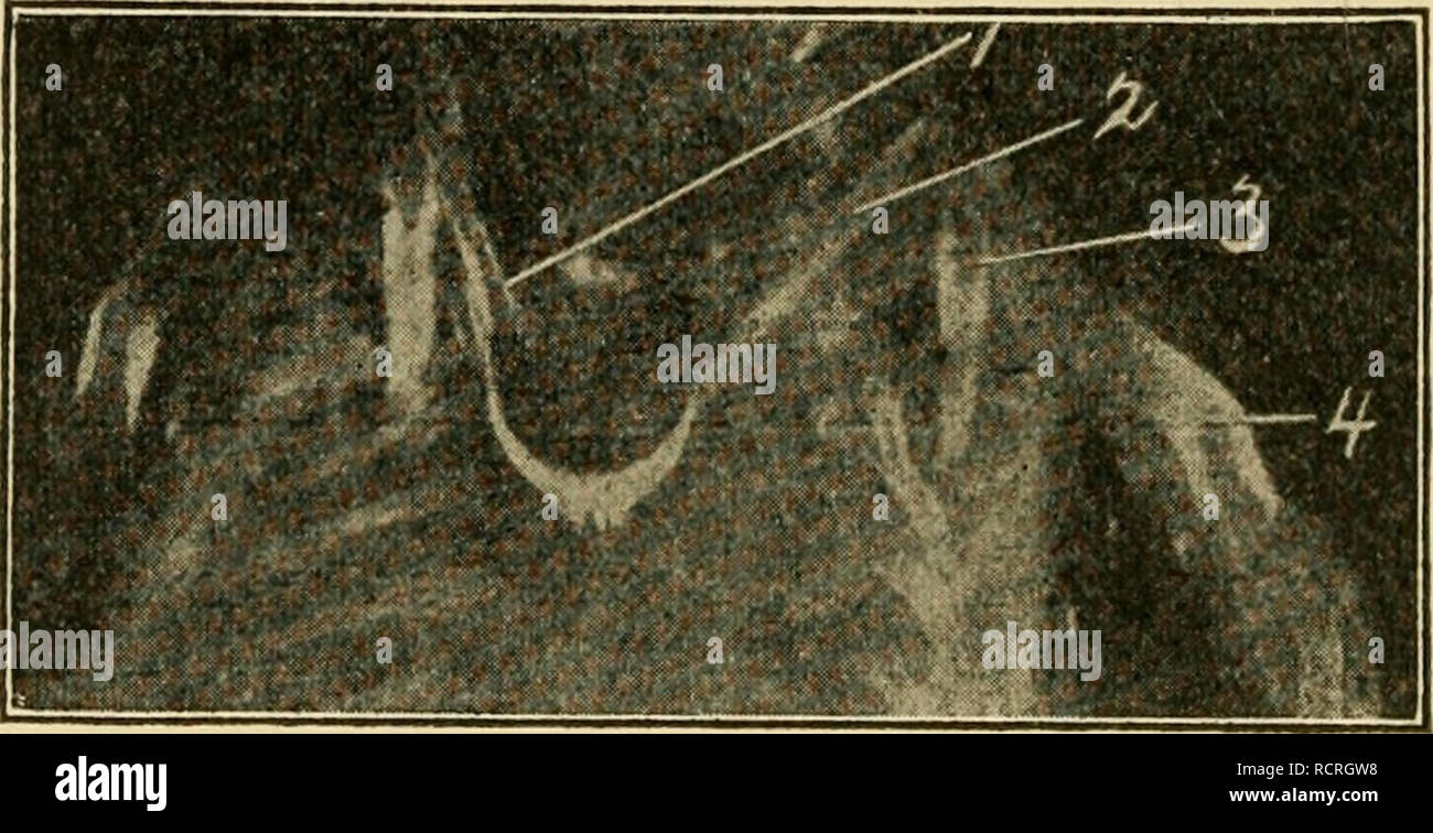 Ossification center hi-res stock photography and images - Alamy