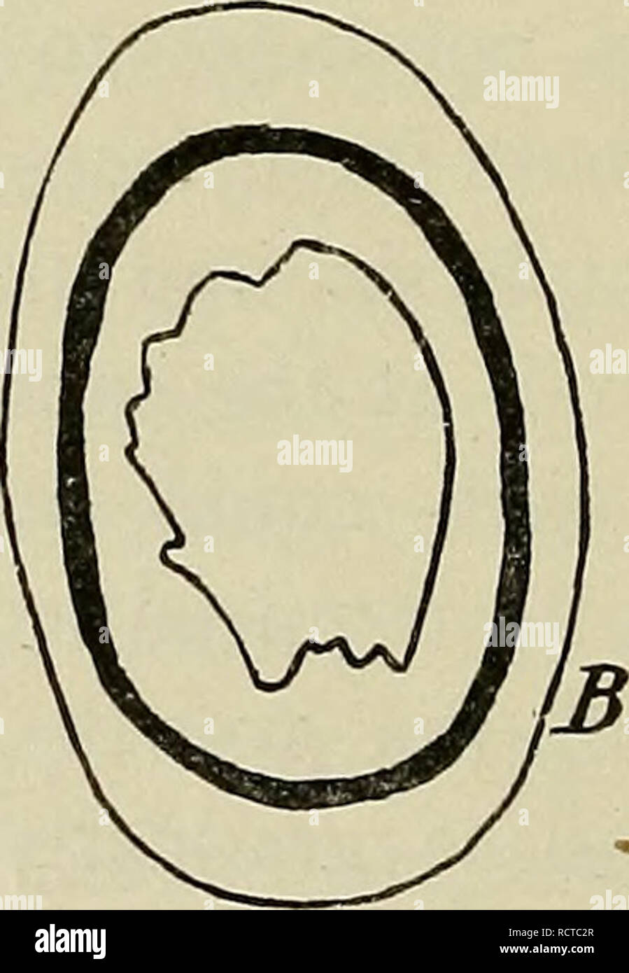 Pig embryo human hi-res stock photography and images - Alamy