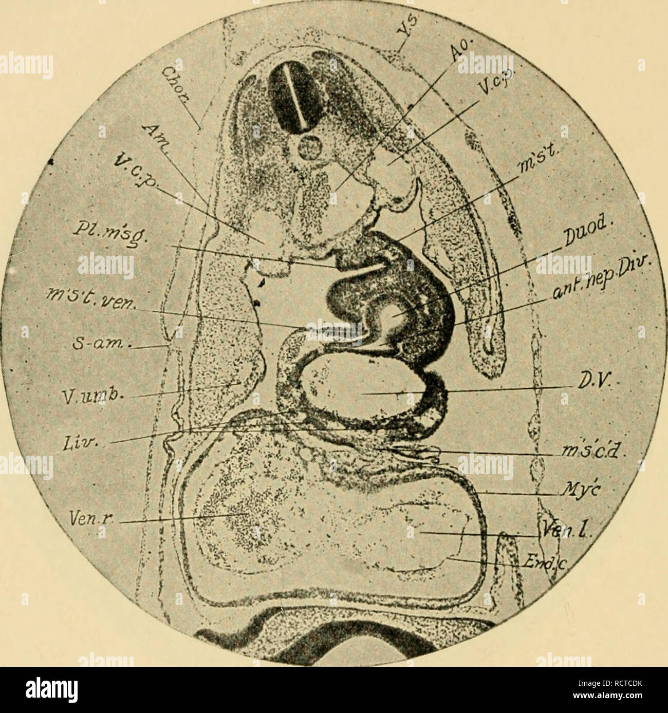 Peritoneal Cavity High Resolution Stock Photography and Images - Alamy