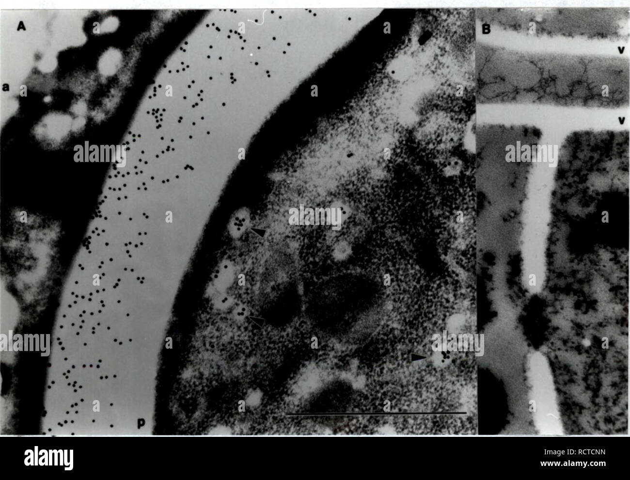 . Development of cytochemical methods for the study of ascospore wall ...