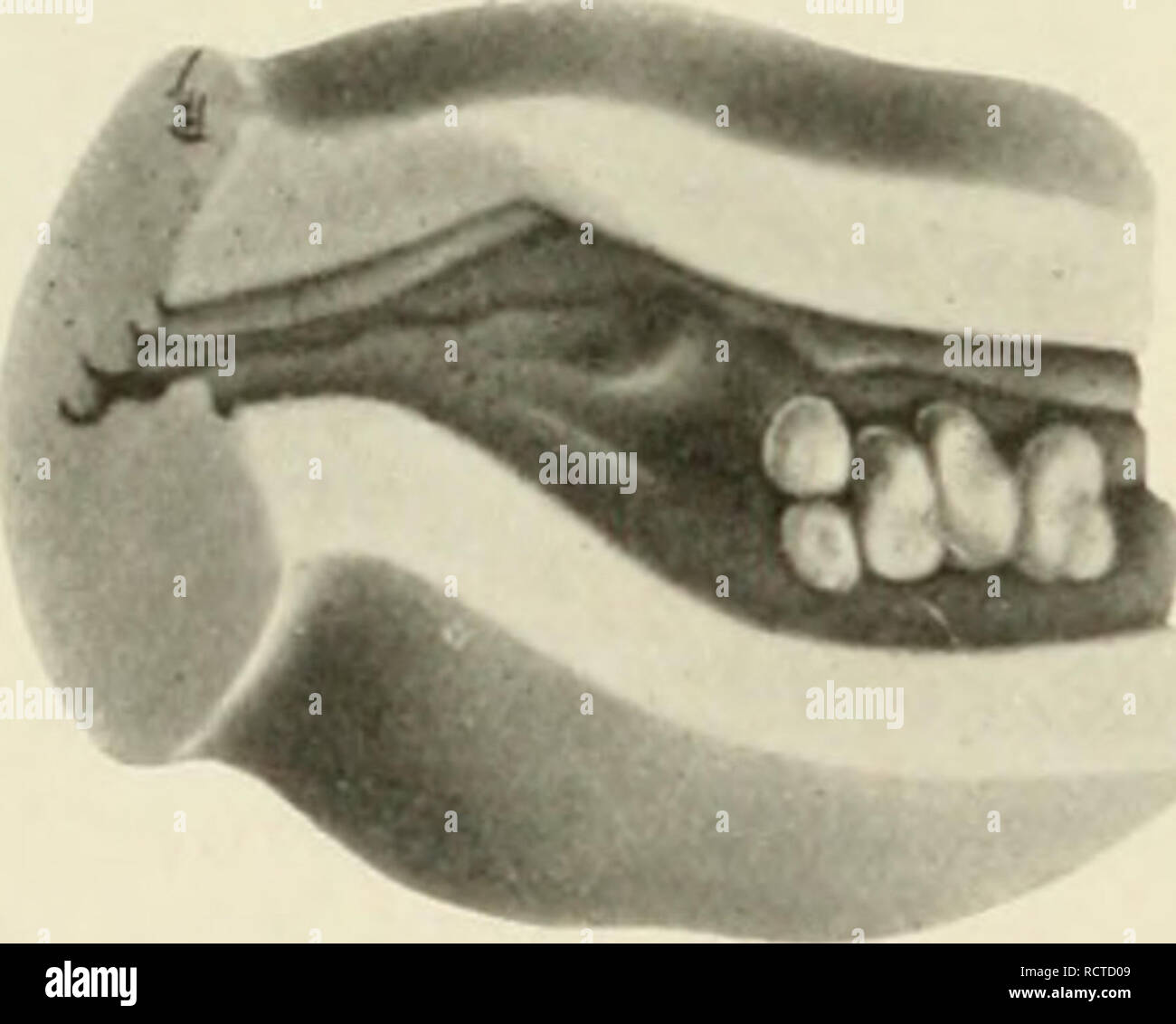 . The development of the albino rat, Mus norvegicus albinus. Embryology ...