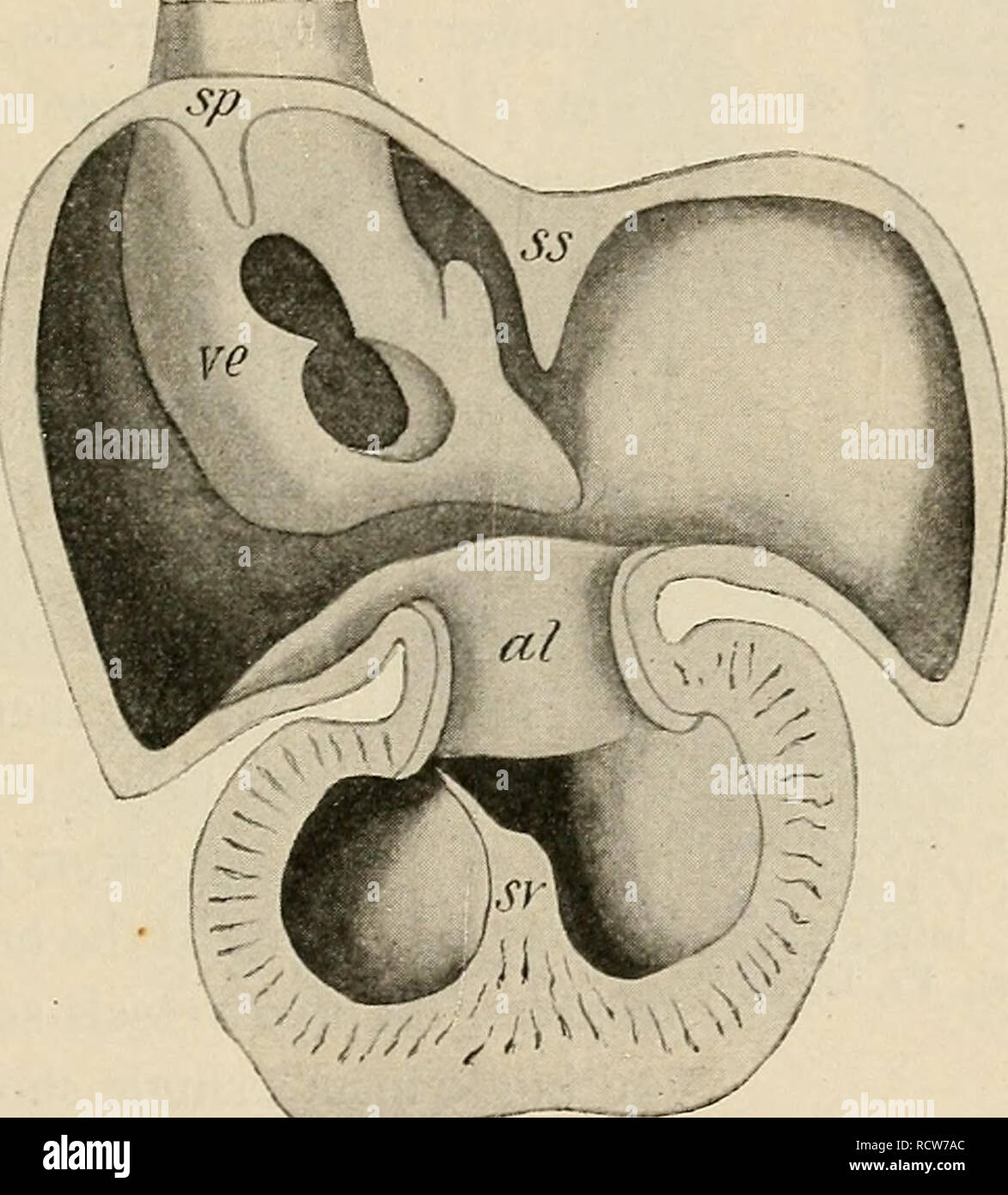 Atrial septum hi-res stock photography and images - Alamy
