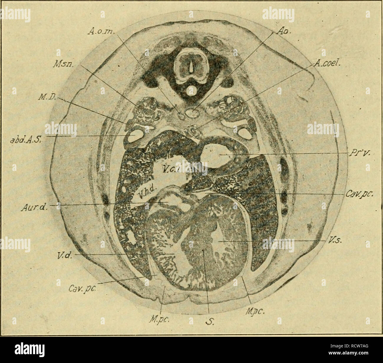 Septum transversum hi-res stock photography and images - Alamy