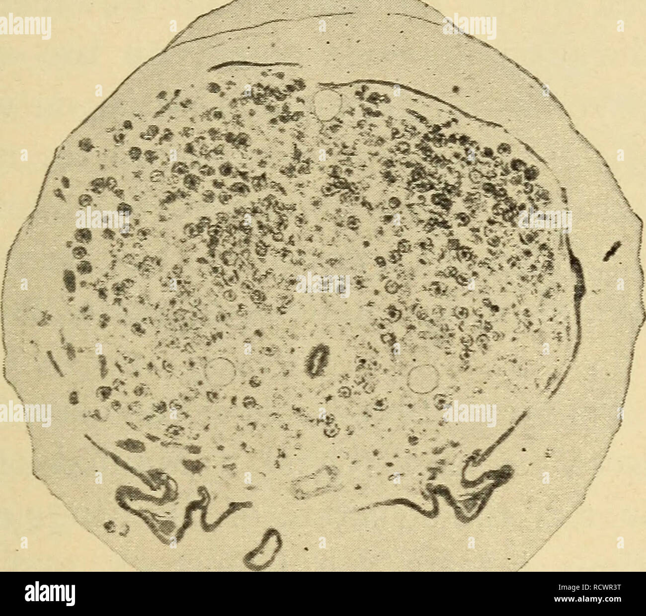 Legless larvae hi-res stock photography and images - Alamy