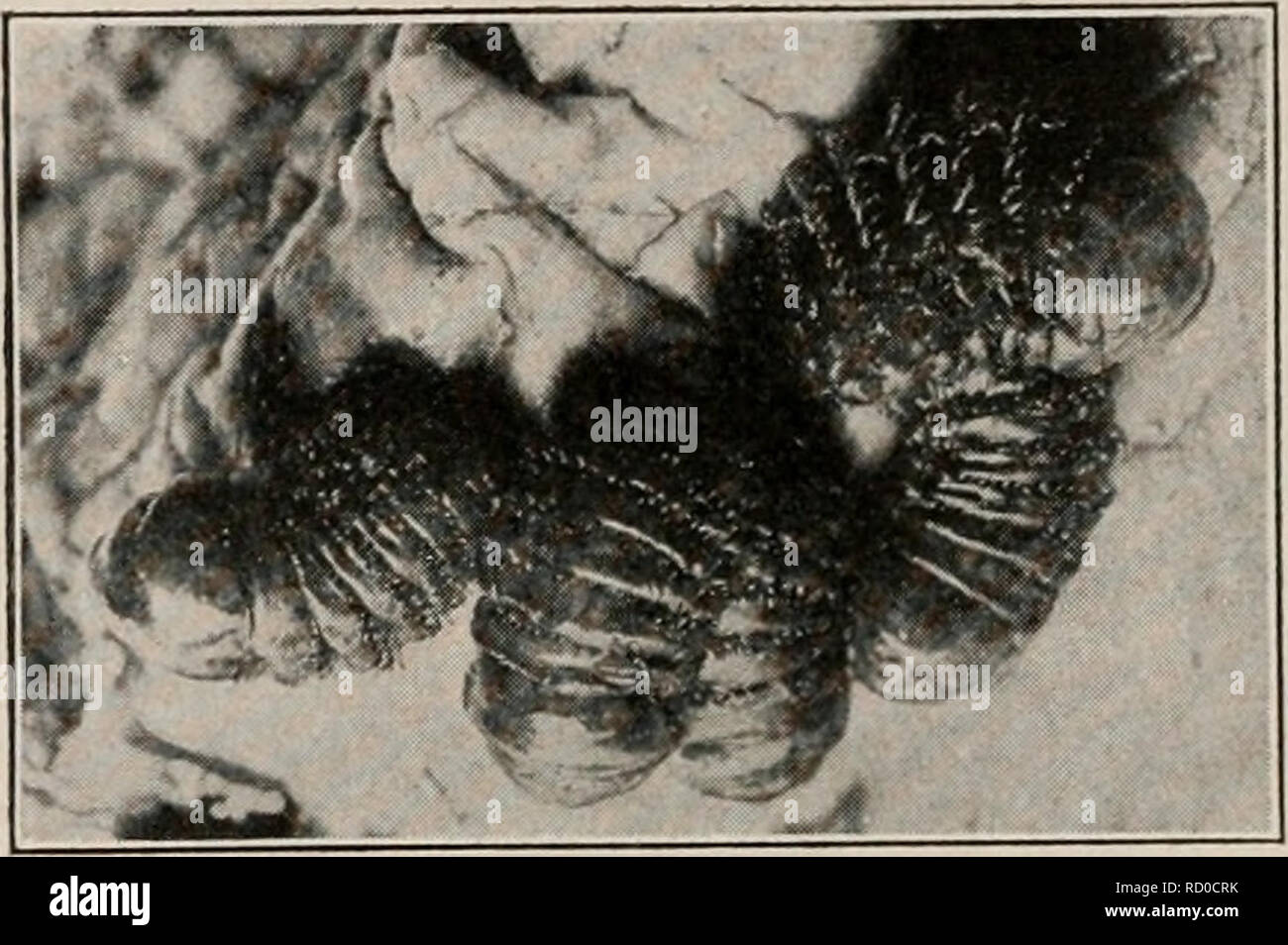 Bot fly larvae hi-res stock photography and images - Alamy