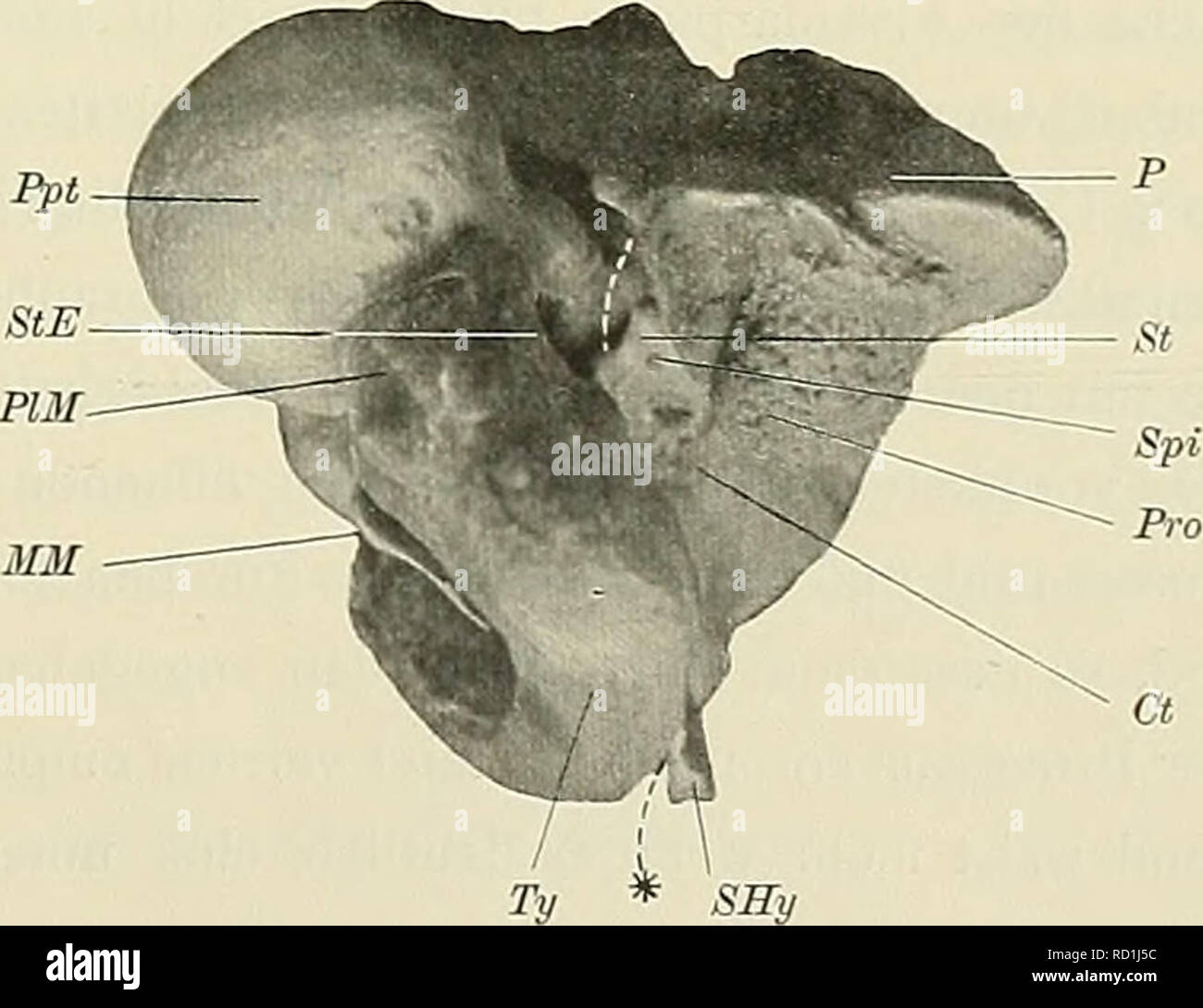 Mediolateral hi-res stock photography and images - Alamy