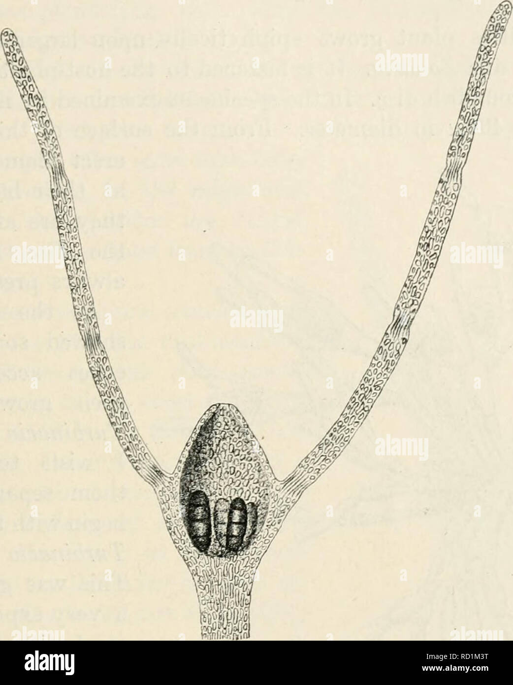 Transverse pin hi-res stock photography and images - Alamy