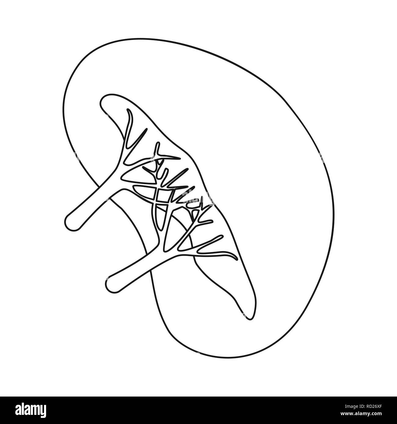 kidney,urinary,transplant,stones,diagram,disease,donation,beans,anatomy ...