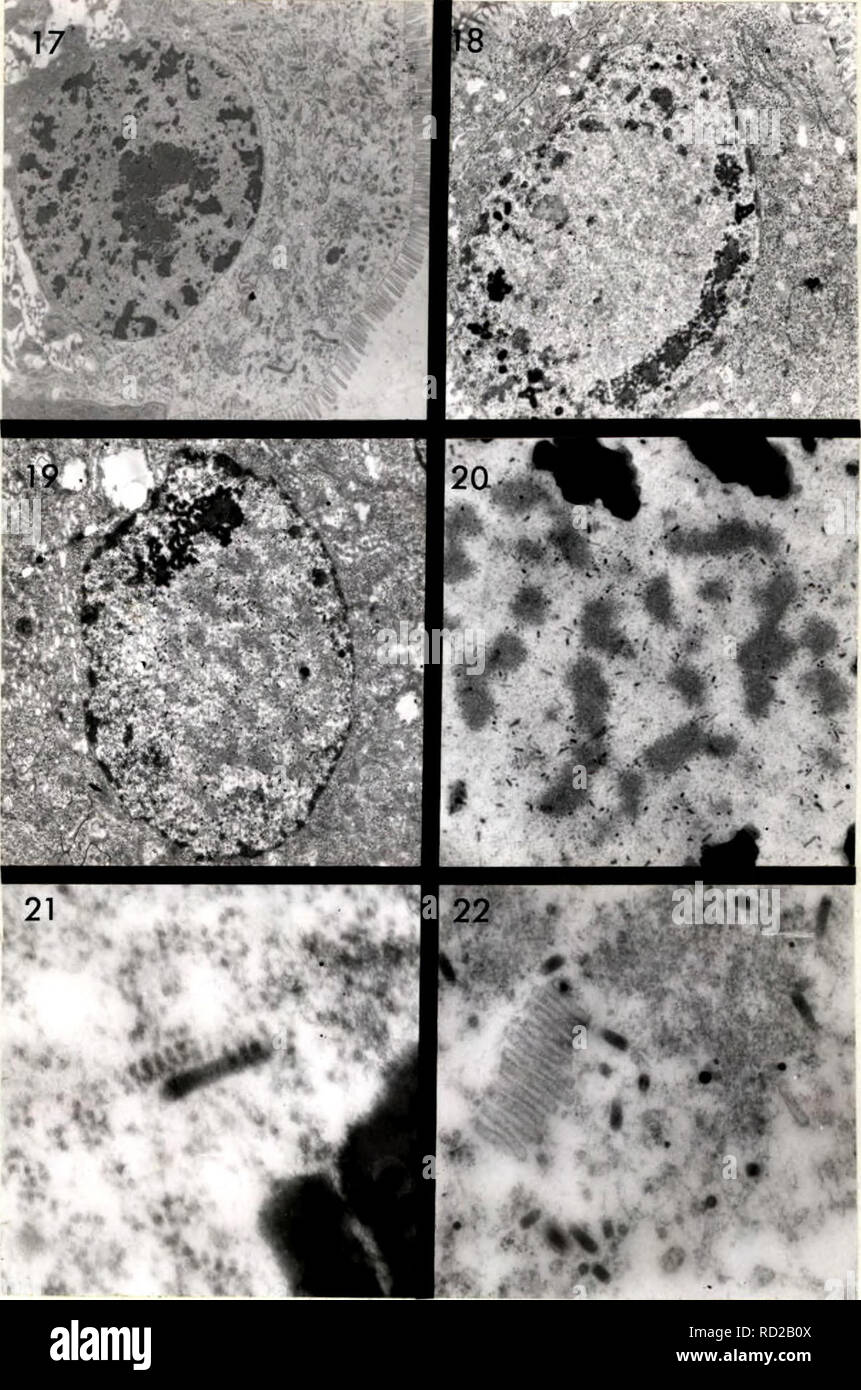 . Cytopathology of a nuclear polyhedrosis virus in Aedes triseriatus ...
