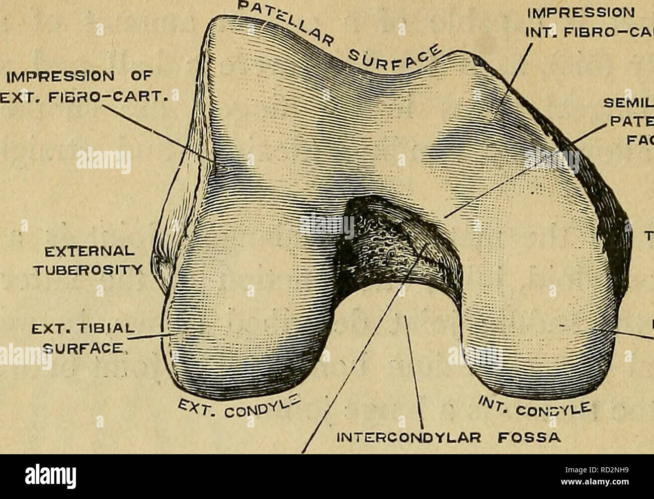 Intercondylar Notch Femur