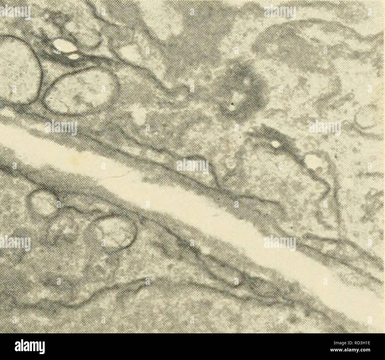 Endoplasmic reticulum micrograph hi-res stock photography and images ...