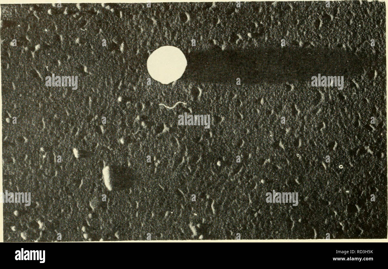 Ribosomes micrograph hi-res stock photography and images - Alamy