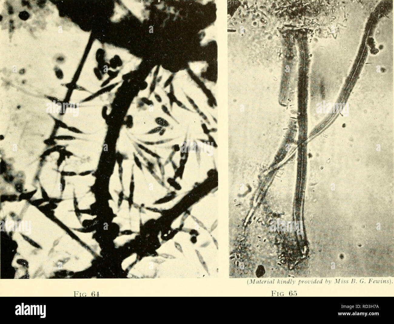 Colloidal clumps hi-res stock photography and images - Alamy