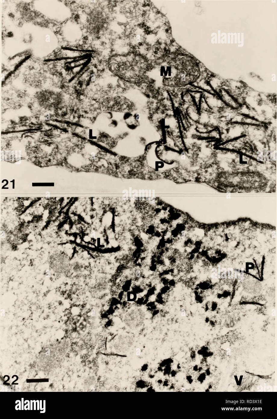 Inclusions bodies pinwheel hi-res stock photography and images - Alamy