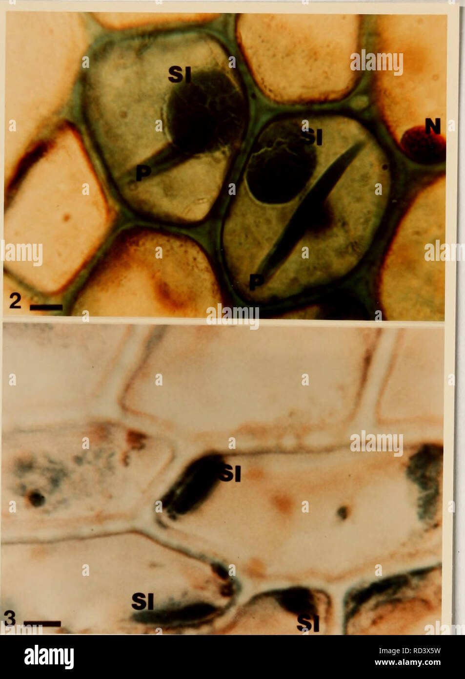 Cell Inclusions In Plants