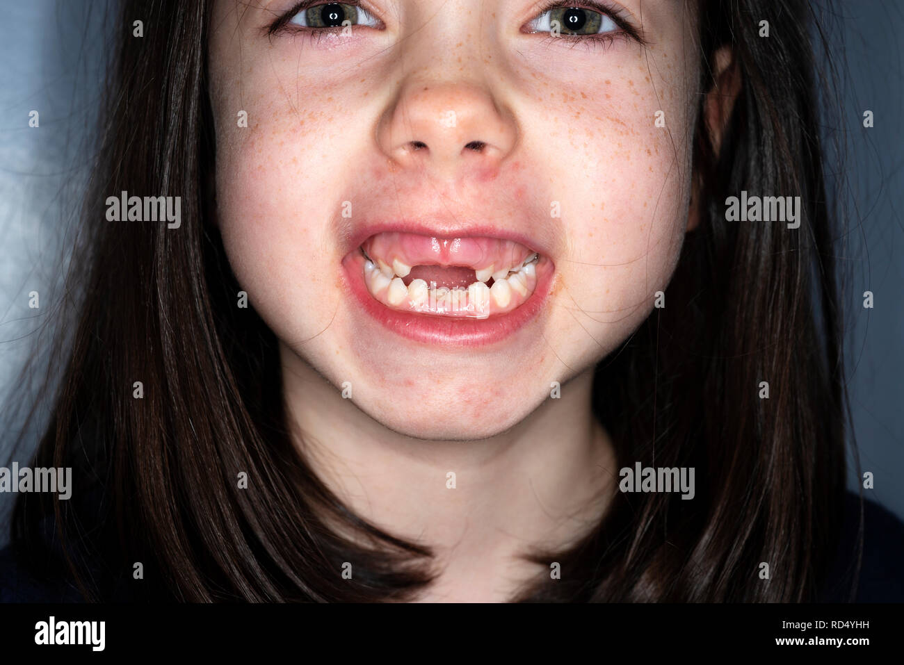 Smile with missing teeth hi-res stock photography and images - Alamy