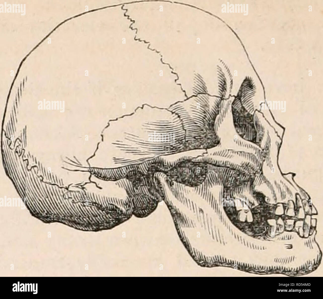 Prognathous hi-res stock photography and images - Alamy