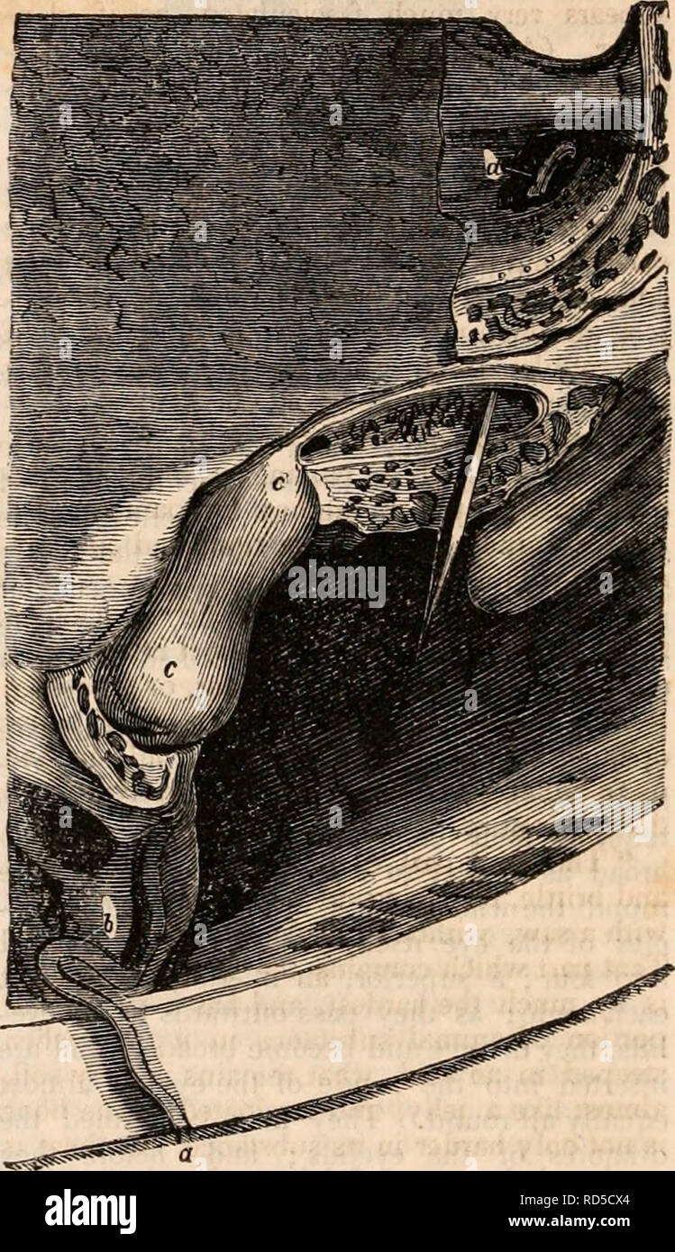 Strong flattened shape hi-res stock photography and images - Alamy