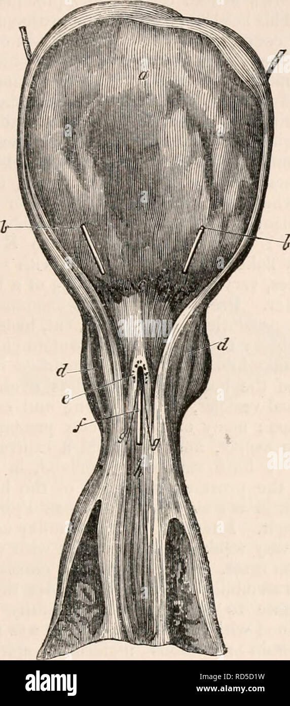 Prostatic Sinus