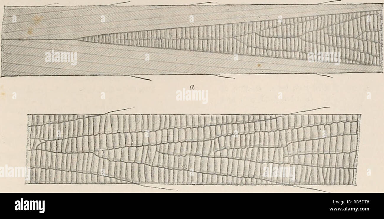 Superficial transverse muscle hi-res stock photography and images - Alamy